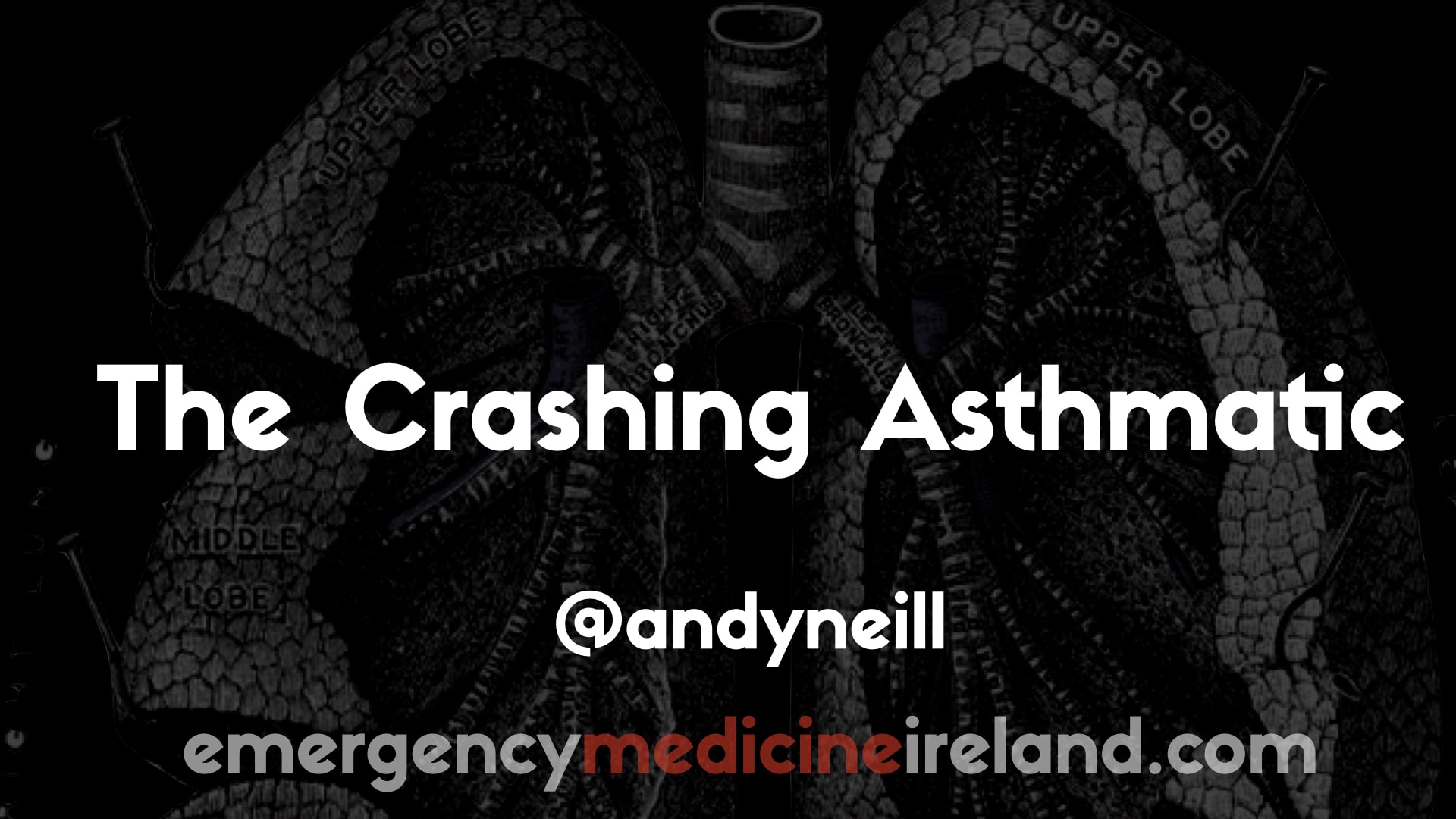 Crashing asthmatic at EuSEM 2021 – Emergency Medicine Ireland